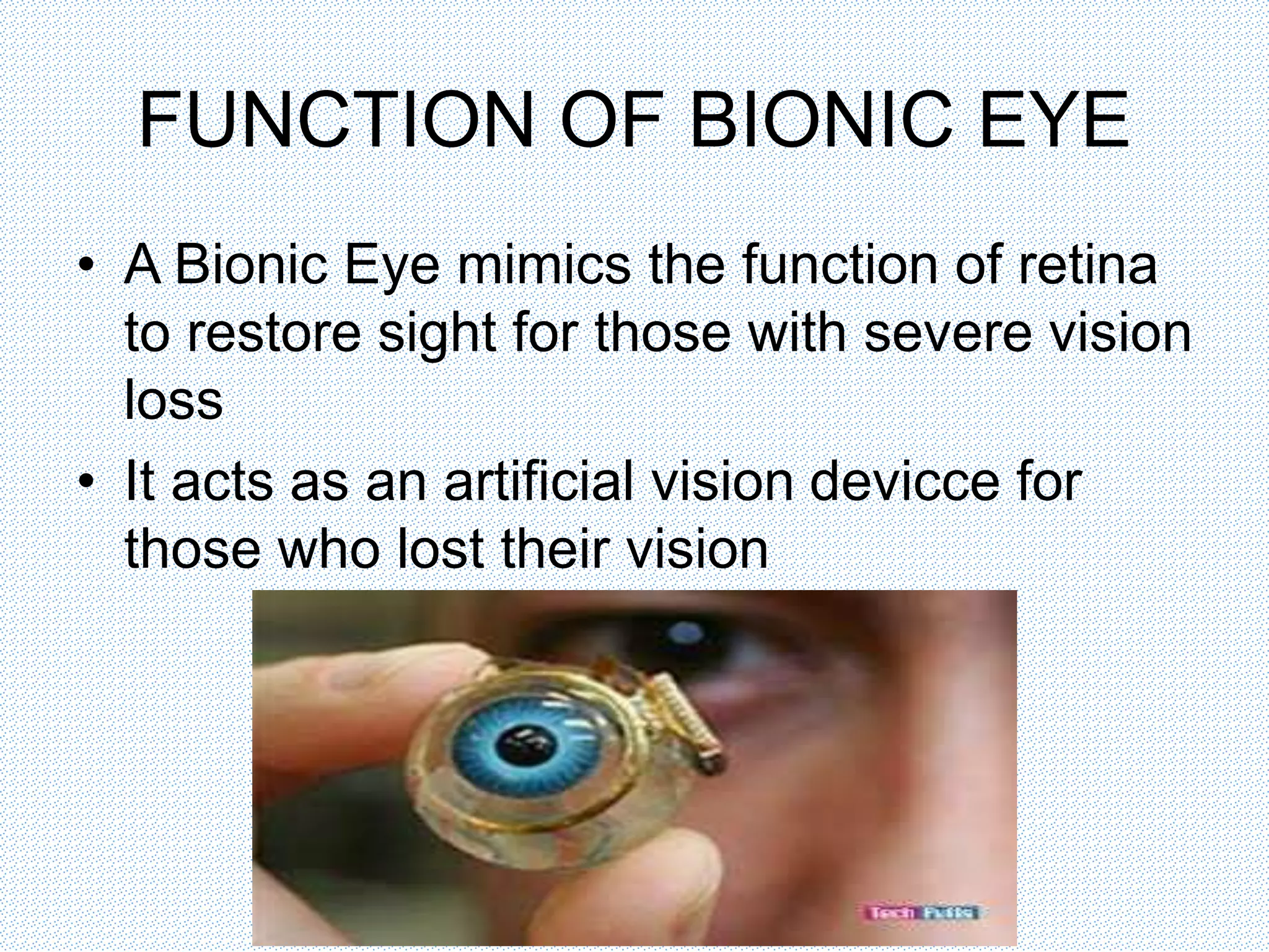 Bionic EYE | PPTX