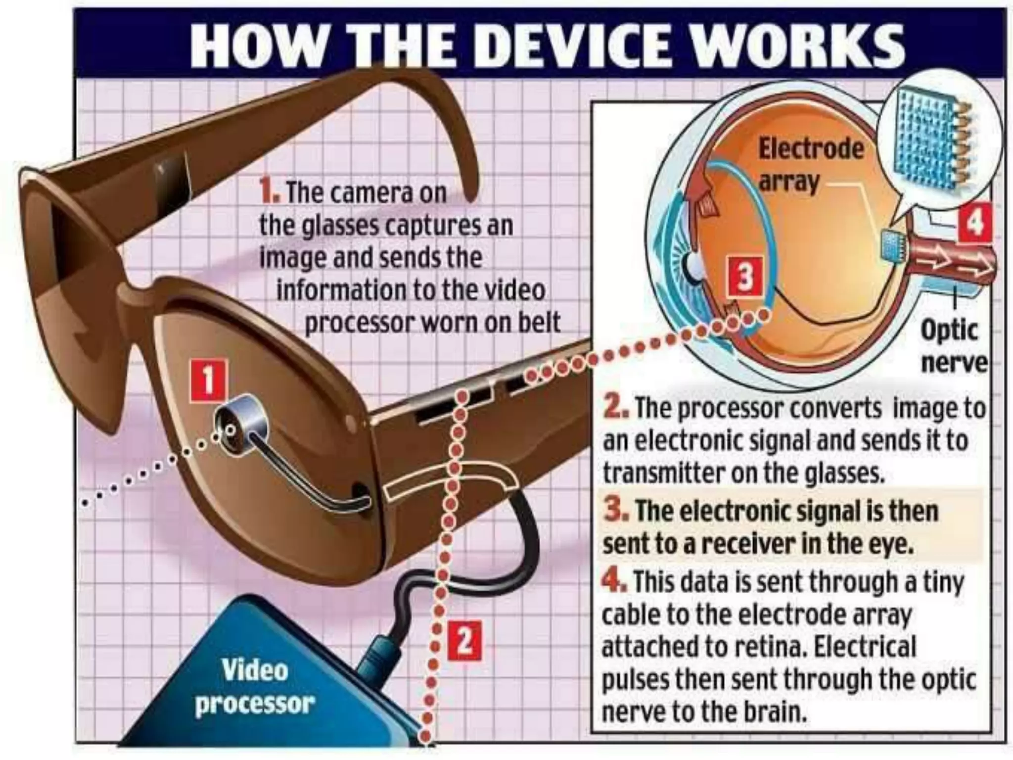 Bionic EYE | PPTX