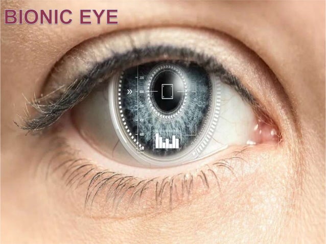 Bionic EYE | PPT