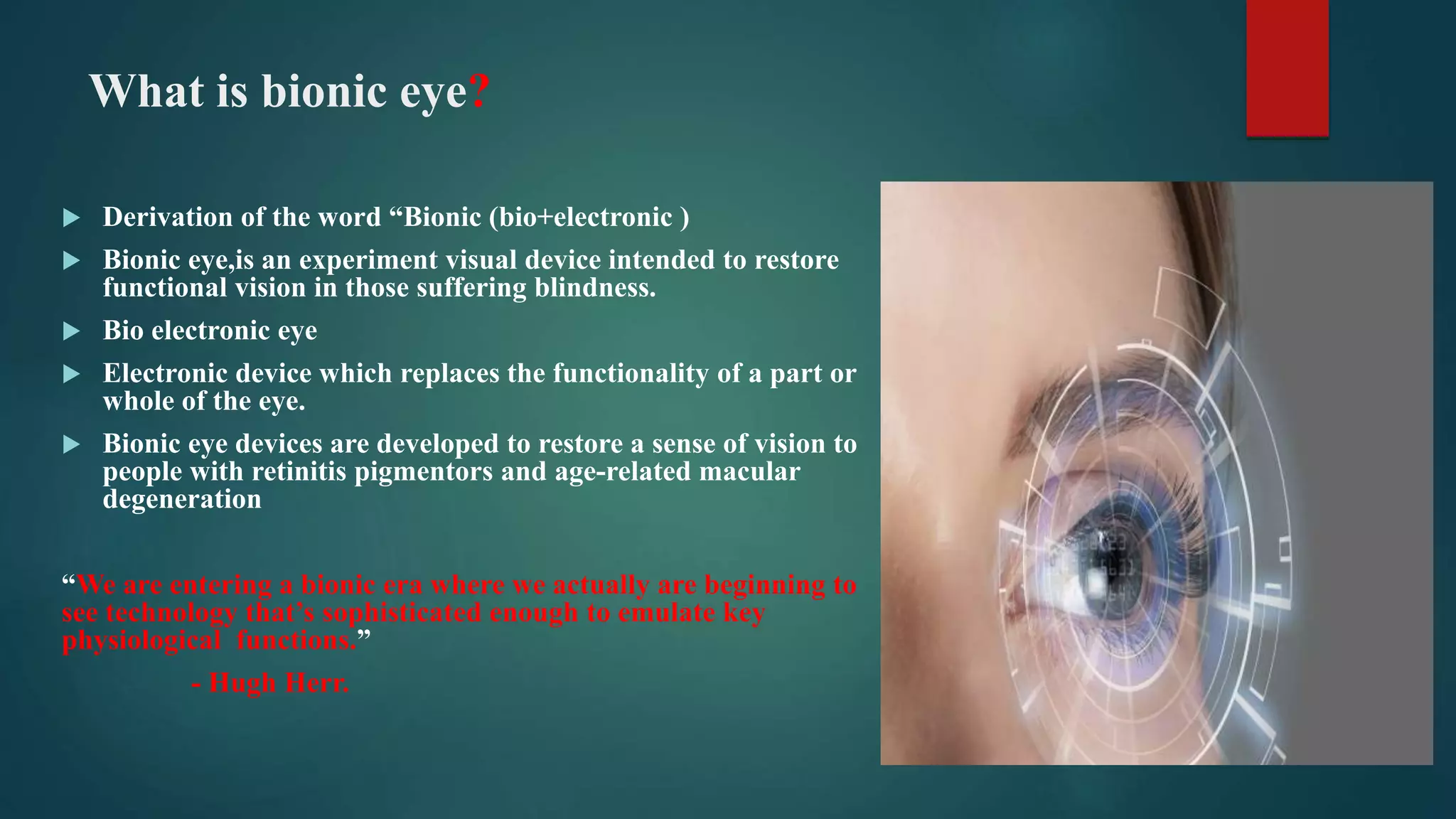 Bionic eye.pptx