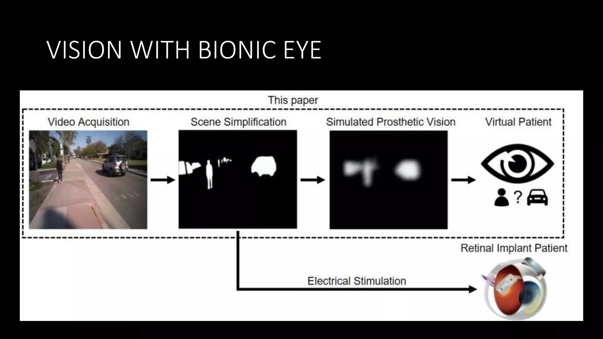 Bionic eye.pptx