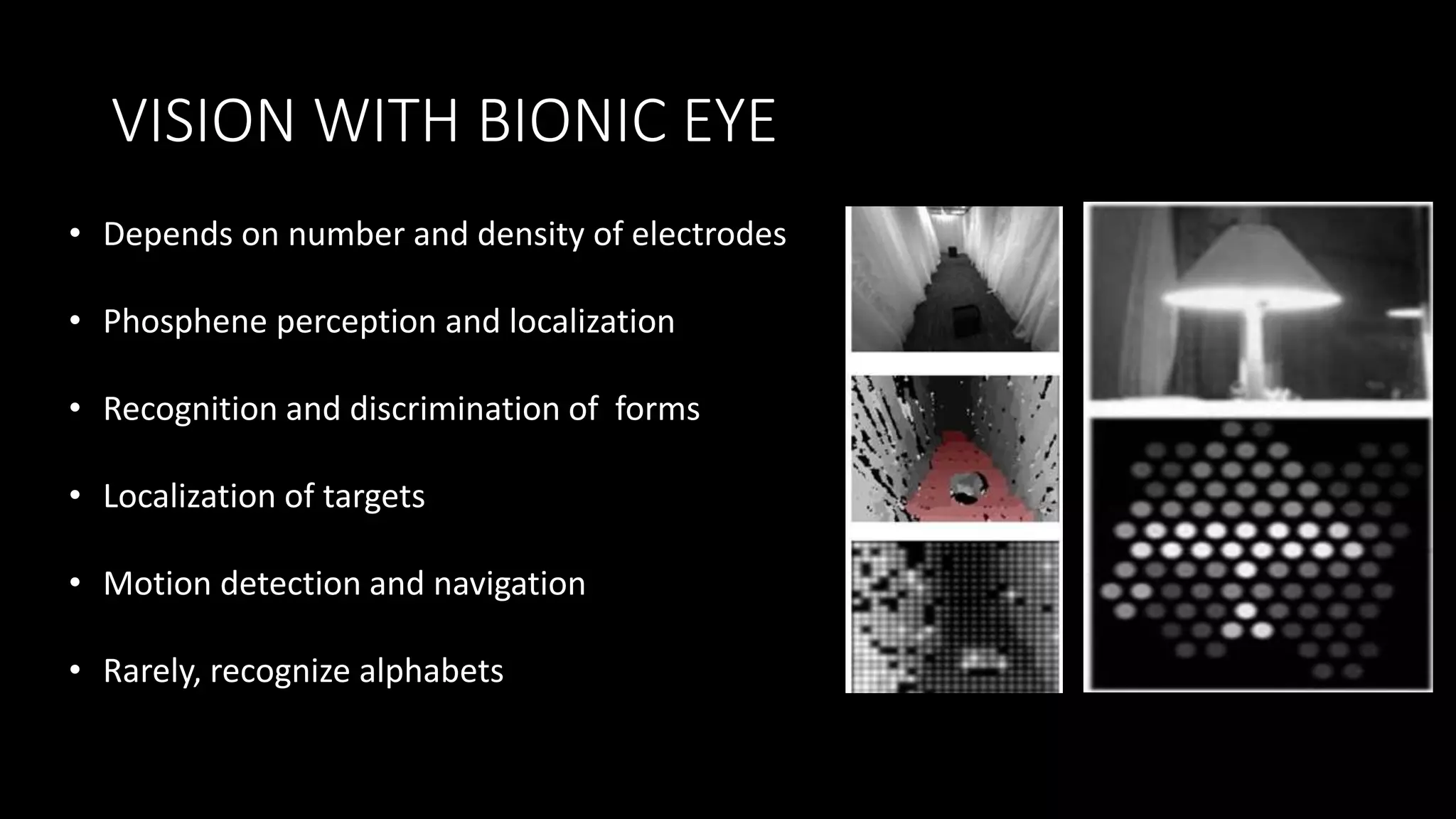 Bionic eye.pptx