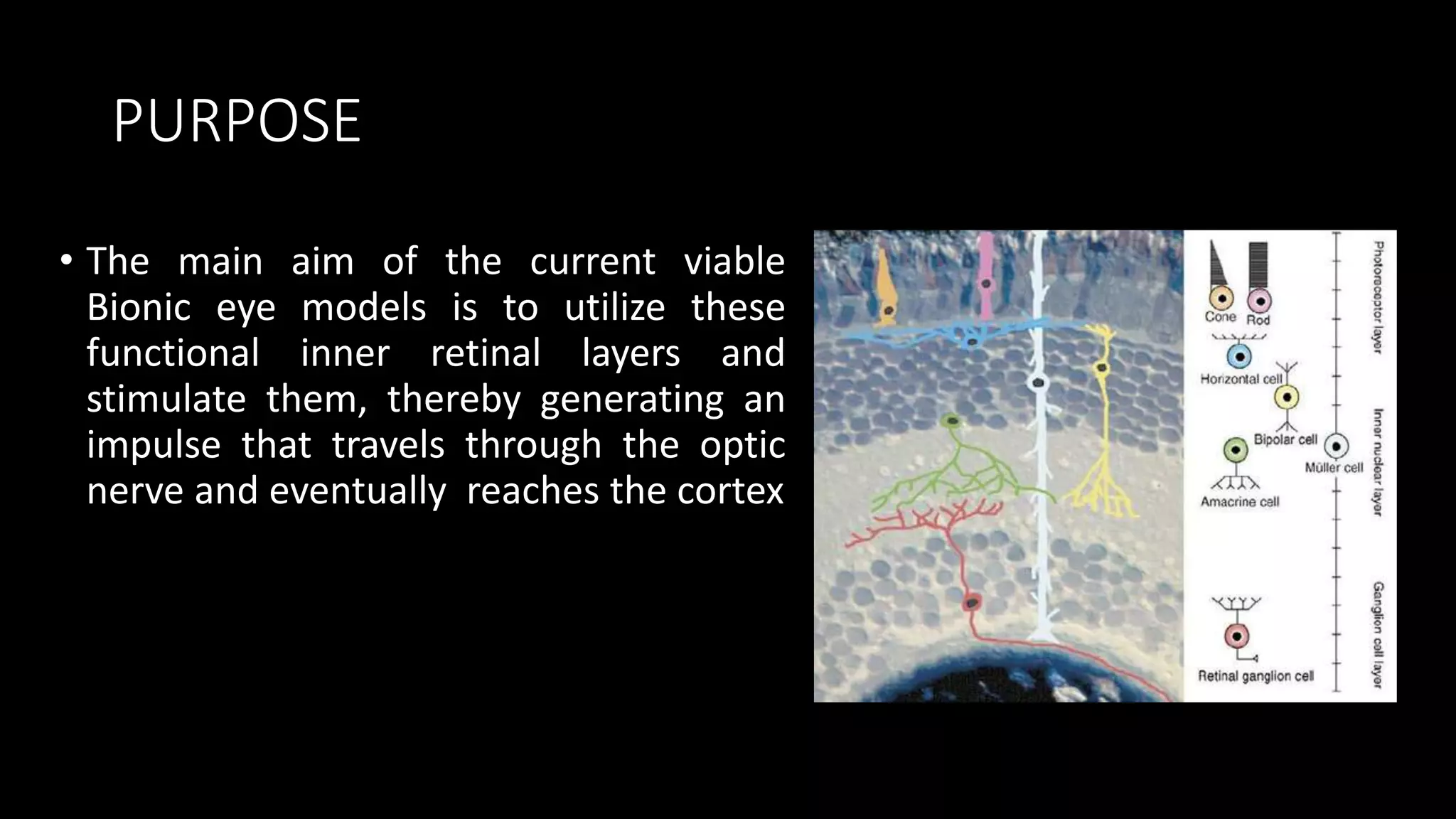 Bionic eye.pptx