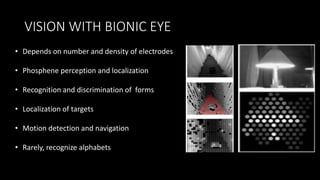 Bionic eye.pptx