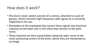 Bionic Eye.pptx