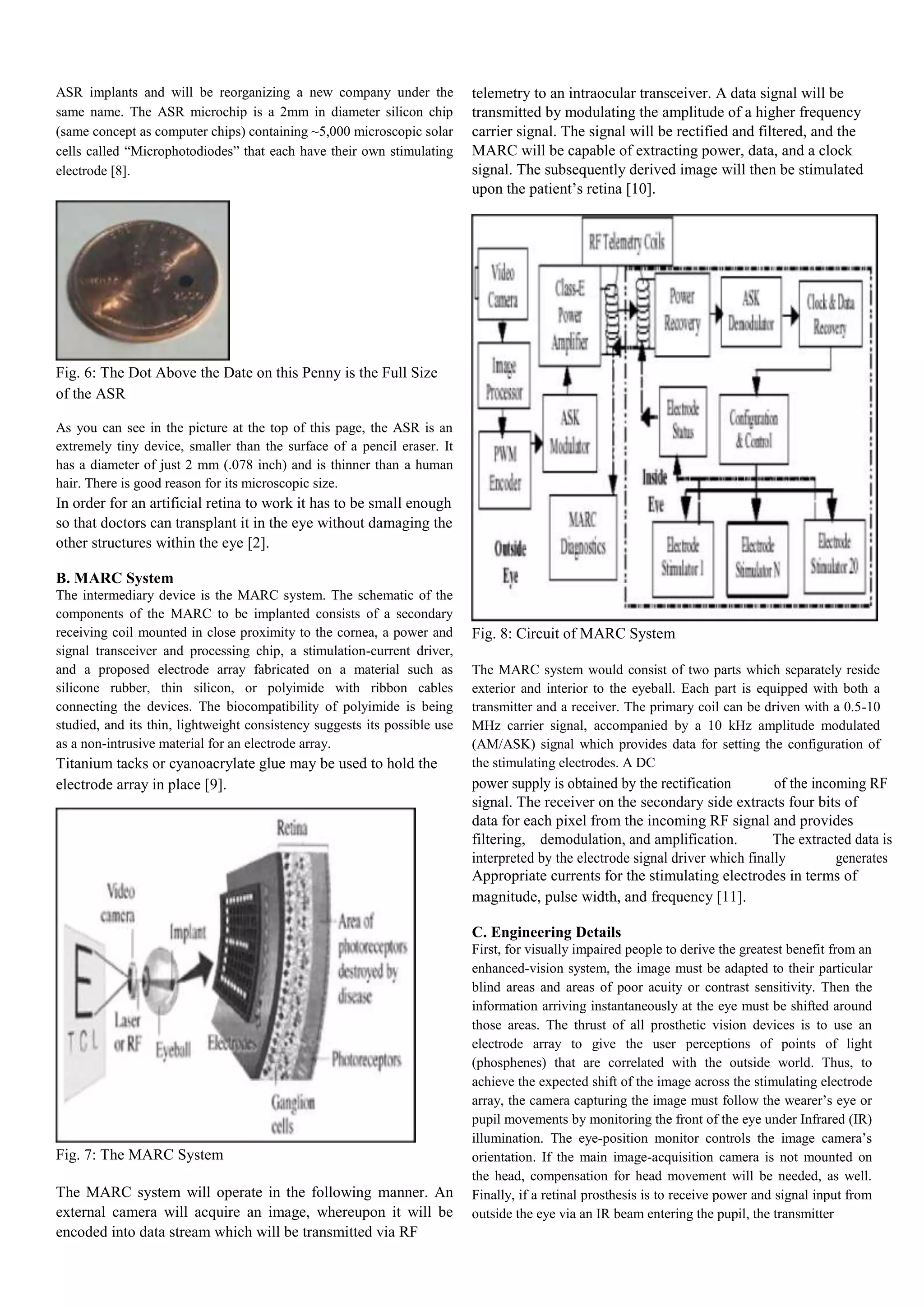 Bionic eye hard copy | PDF