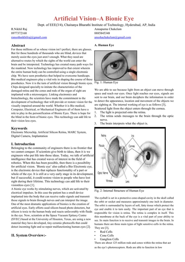 Bionic eye hard copy | PDF