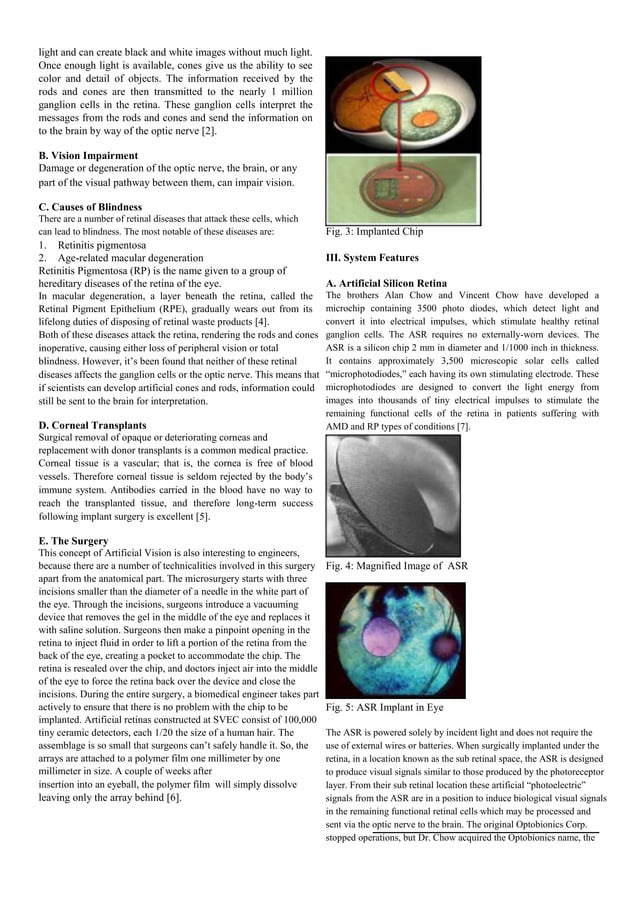Bionic eye hard copy | PDF