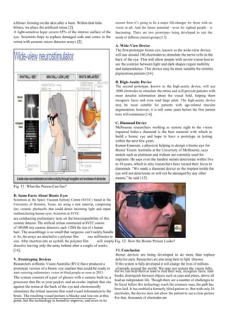 Bionic eye hard copy | PDF