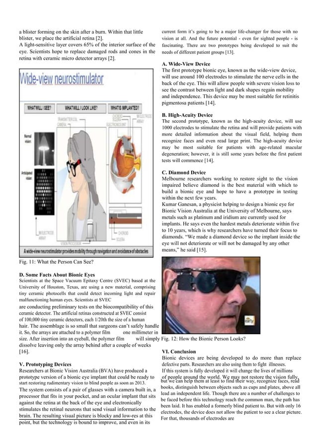 Bionic eye hard copy | PDF