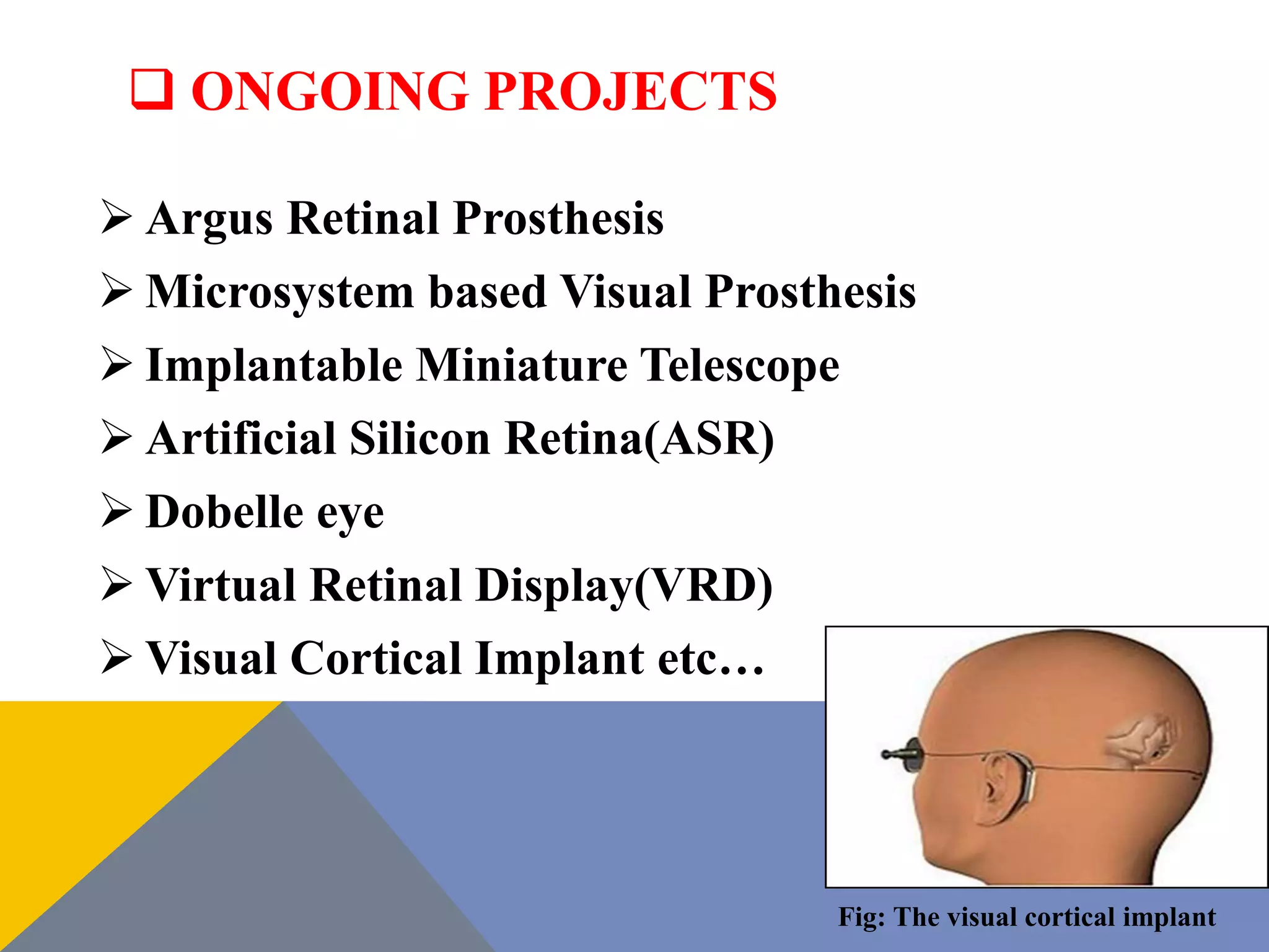 Bionic Eye | PPT