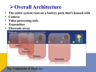 Bionic Eye | PPT