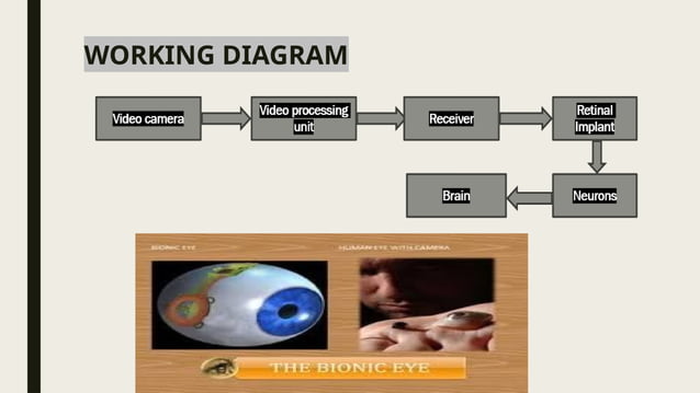 Bionic Eye Final Pptx Hhhhhhhhhhhhhhhhhhhh Ppt