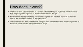 BIONIC EYE FINAL.pptx hhhhhhhhhhhhhhhhhhhh | PPT