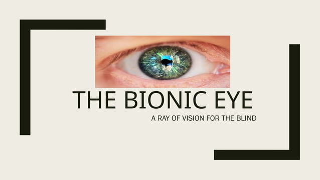 BIONIC EYE FINAL.pptx hhhhhhhhhhhhhhhhhhhh | PPT