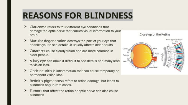 BIONIC EYE FINAL.pptx hhhhhhhhhhhhhhhhhhhh | PPT