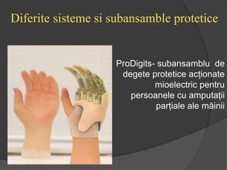 Bionic finger | PPTX