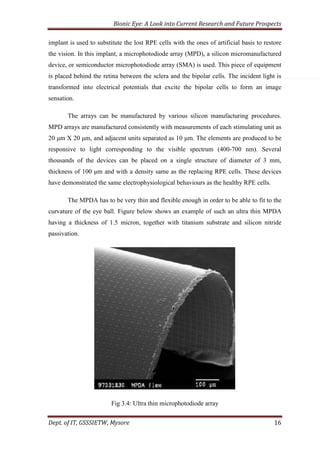 Bionic lens report | PDF