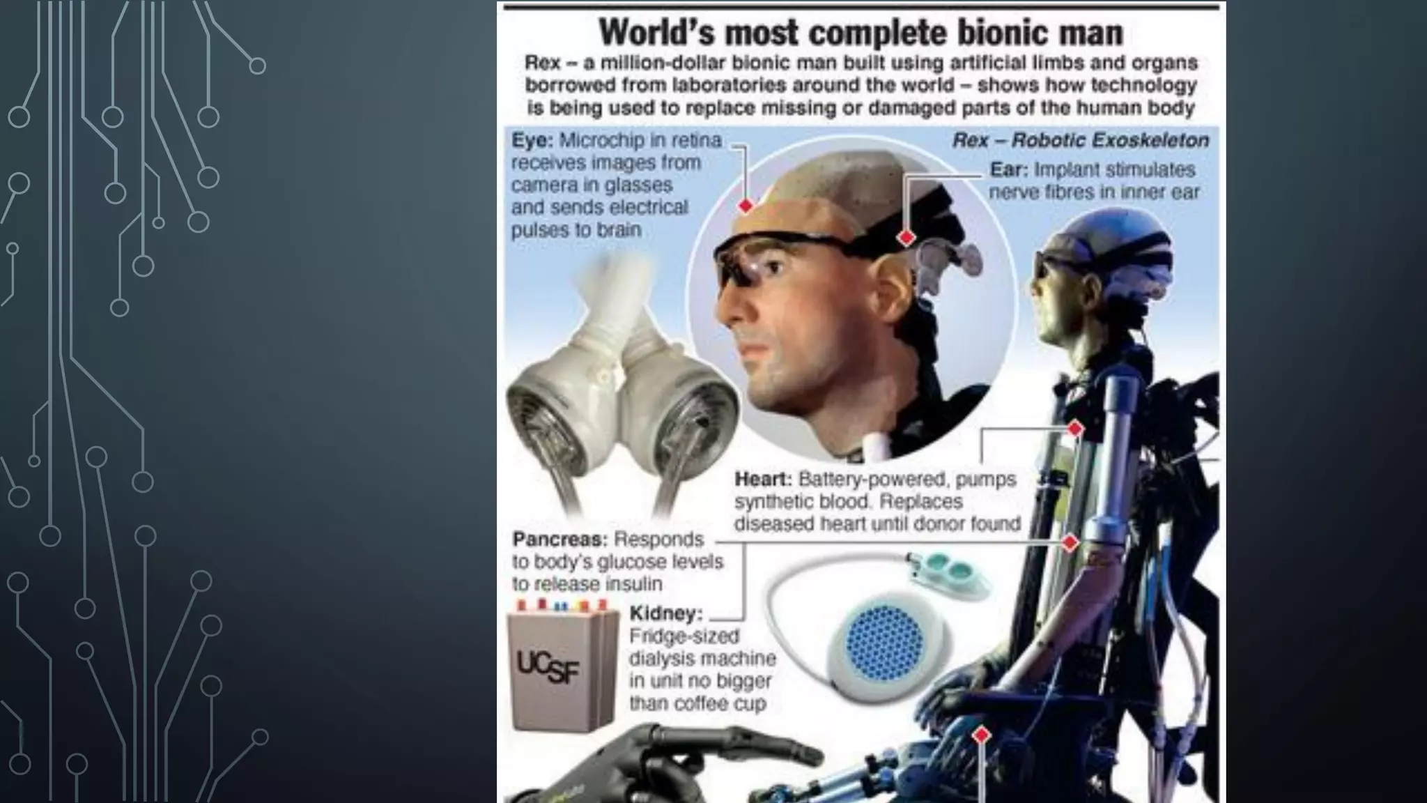 THE TOUCH OF BIONICS IN HUMANS | PDF