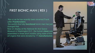 THE TOUCH OF BIONICS IN HUMANS | PDF | Eye and Vision Conditions ...