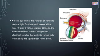 THE TOUCH OF BIONICS IN HUMANS | PDF