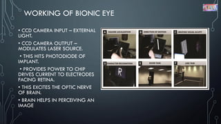 THE TOUCH OF BIONICS IN HUMANS | PDF | Eye and Vision Conditions ...