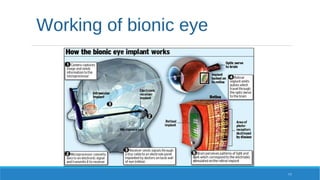 Bionics | PPT