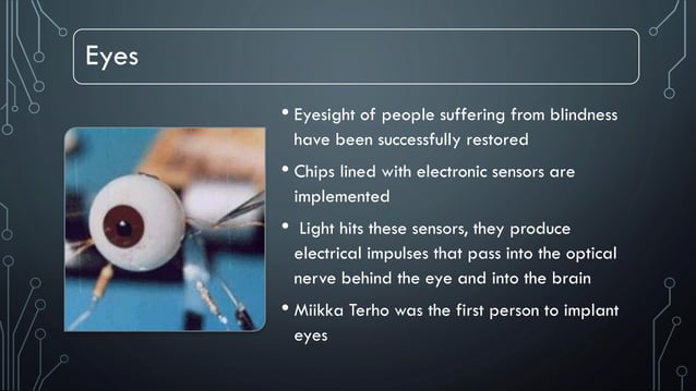 Bionics | PDF | Technology & Computing