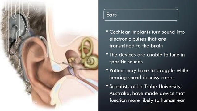 Bionics | PDF | Technology & Computing