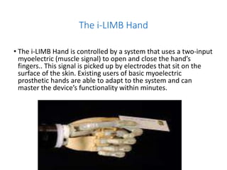 bionics_4.ppt