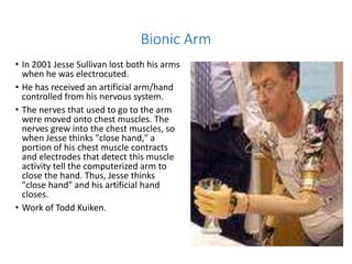 bionics_4.ppt