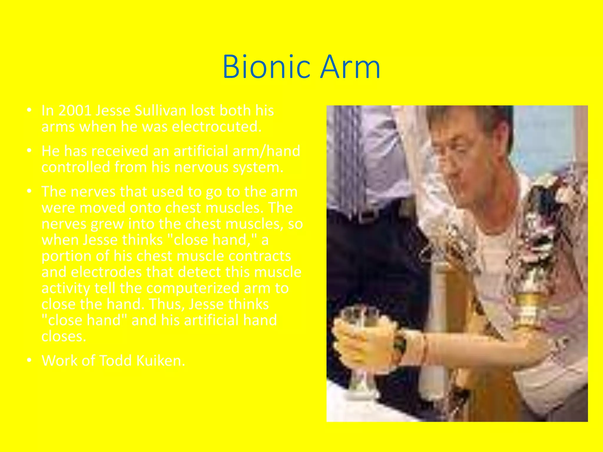 bionics_4.ppt
