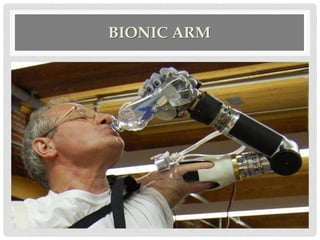 Bionics Technology