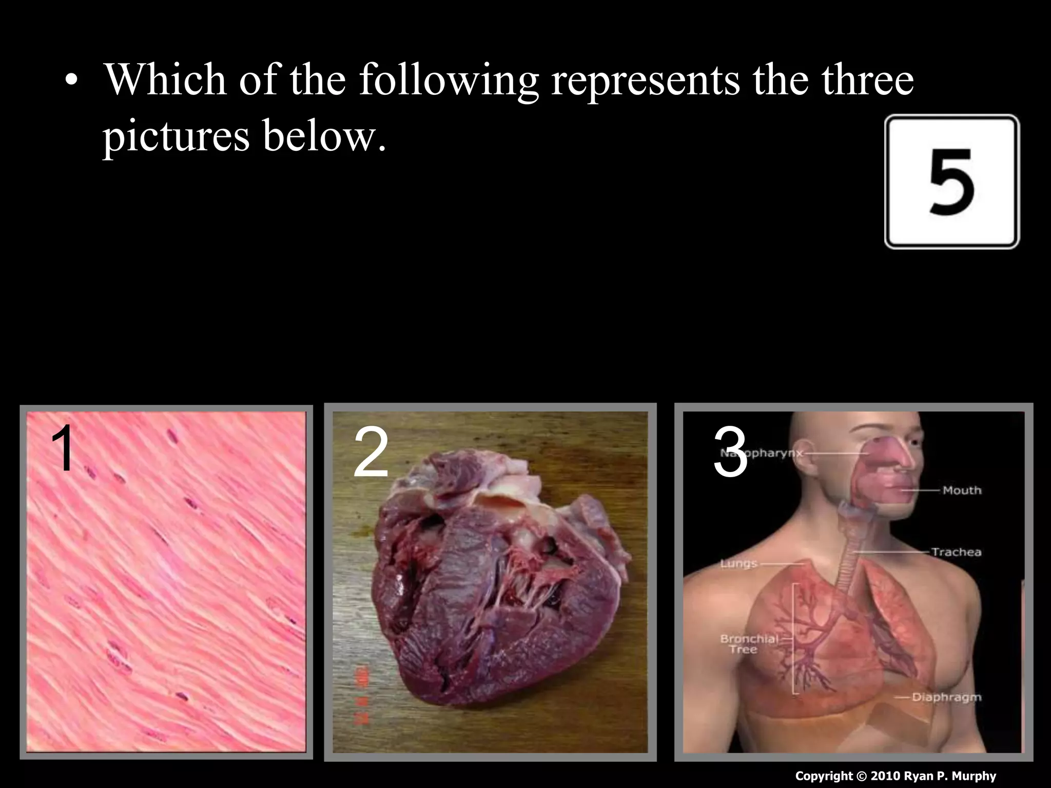 Skeletal System, Muscular System, and Biological Organization ...