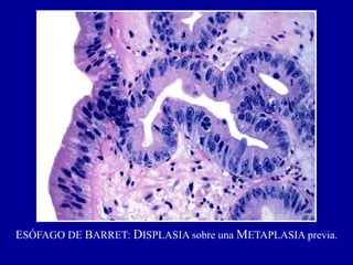 Biopatología estructural de las ram 4 lesiones del tubo digestivo y del ...