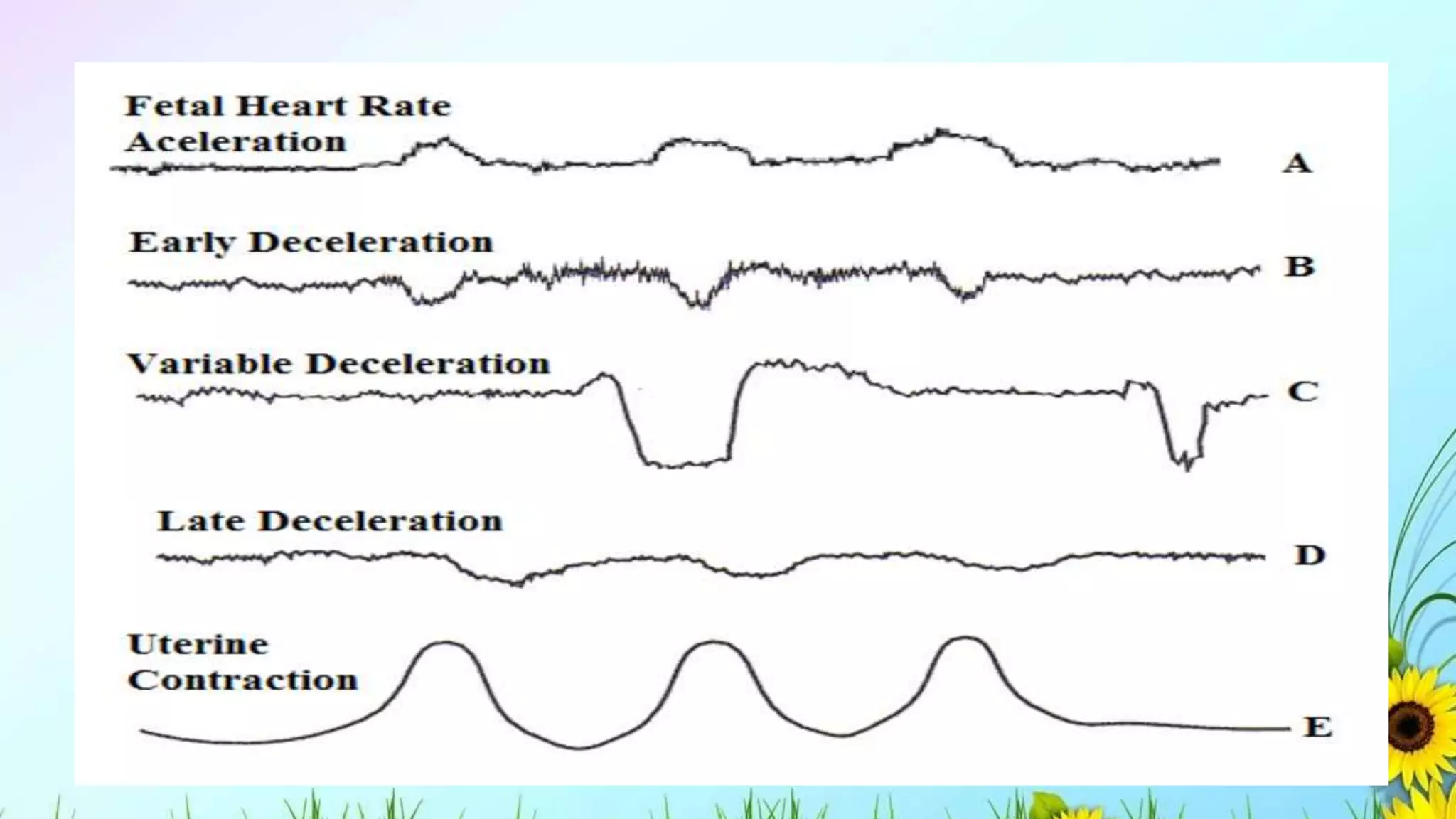 BIOPHYSICAL PRO.pptx