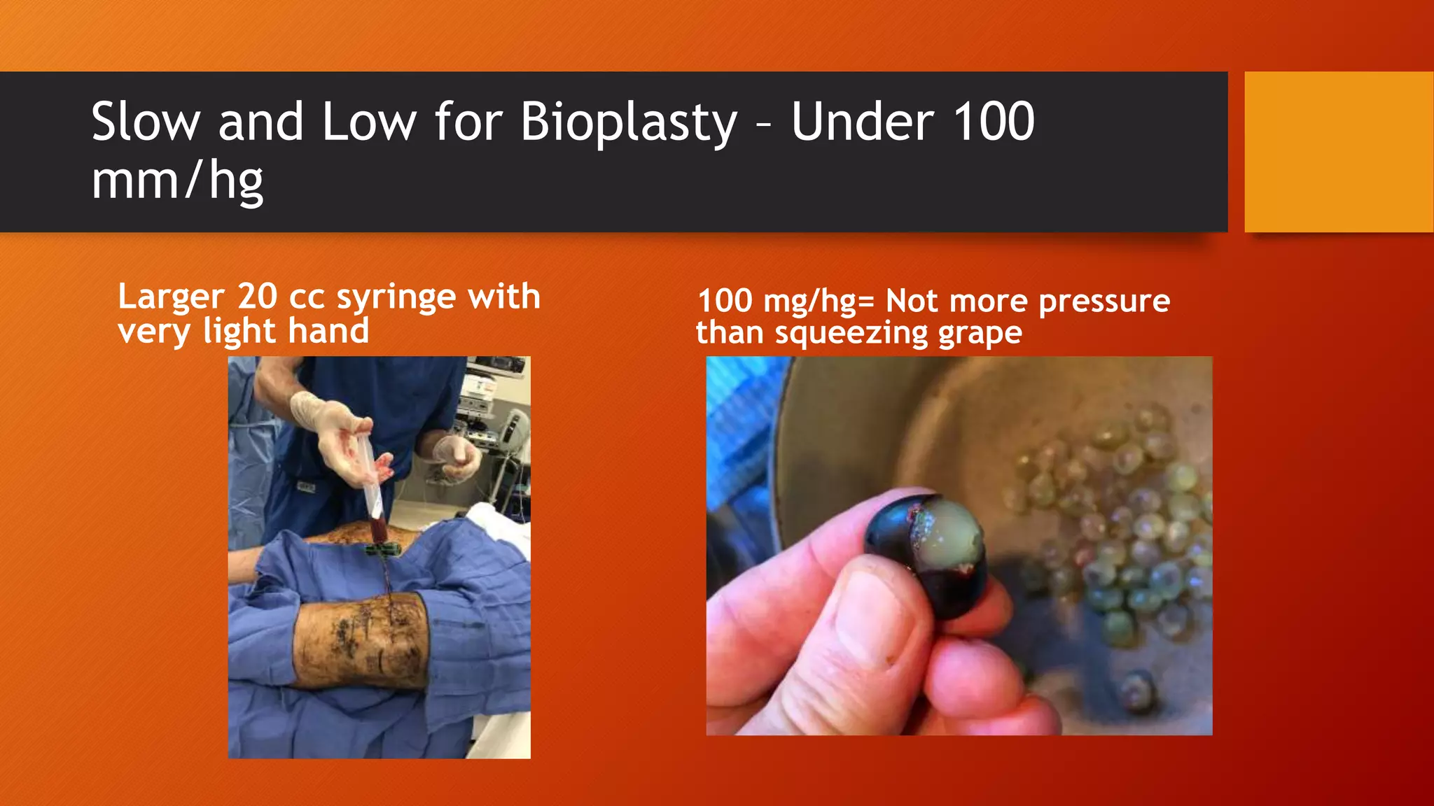 Bioplasty | PPT