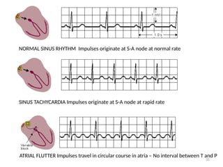 BIOPOTENTIAL RECORDERS(ECG,EEG,EMG)EXPLANATION | PPTX