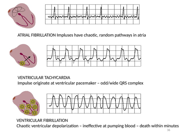 BIOPOTENTIAL RECORDERS(ECG,EEG,EMG)EXPLANATION | PPT