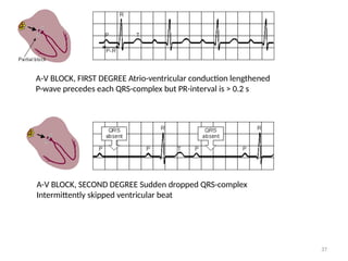 BIOPOTENTIAL RECORDERS(ECG,EEG,EMG)EXPLANATION | PPTX