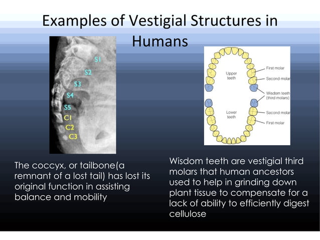 Vestigial Structures | ODP