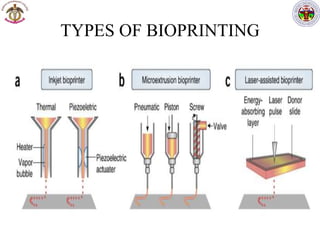 Bioprinting | PPTX
