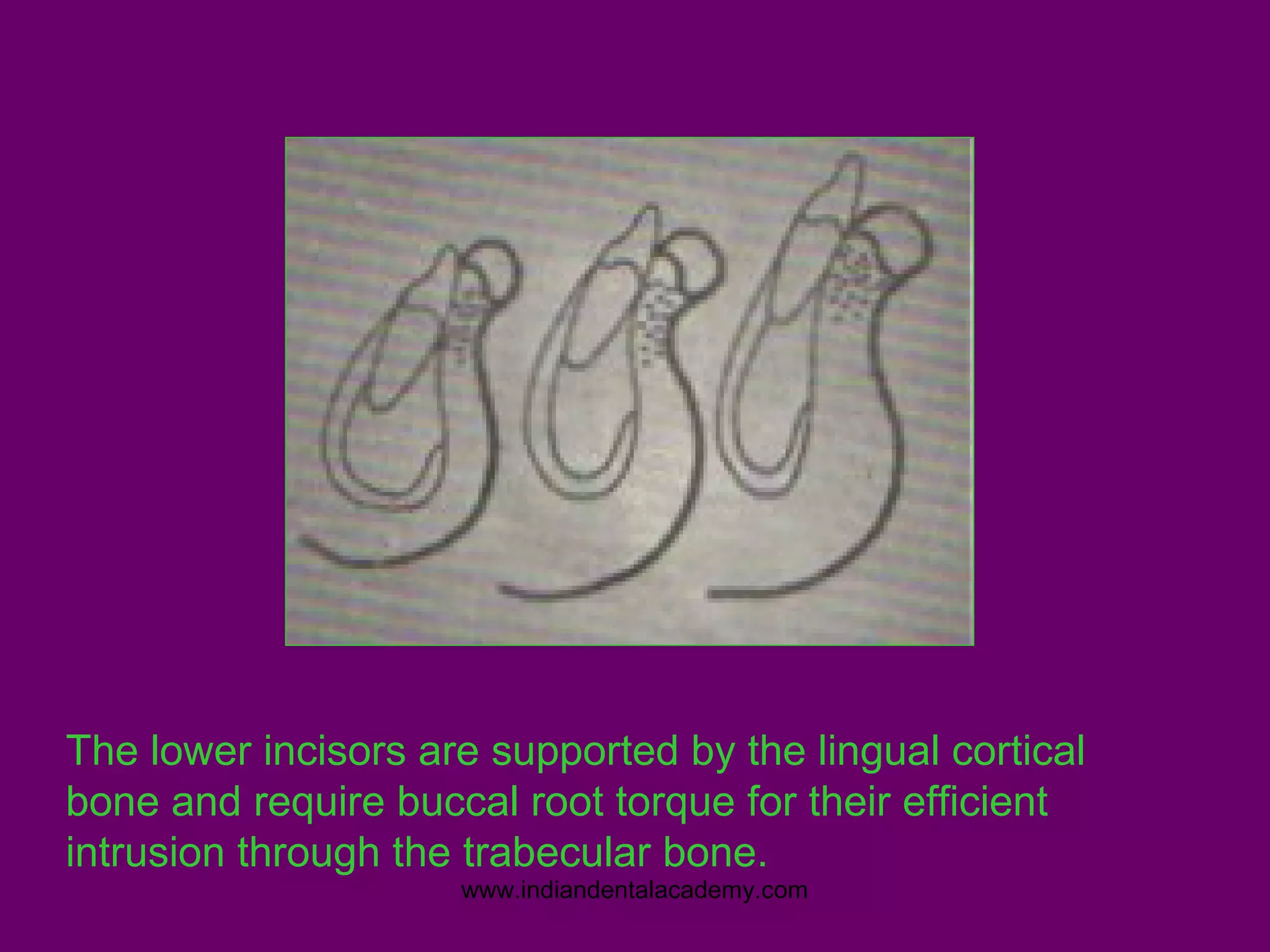 Bioprogressive therapy /certified fixed orthodontic courses by Indian ...