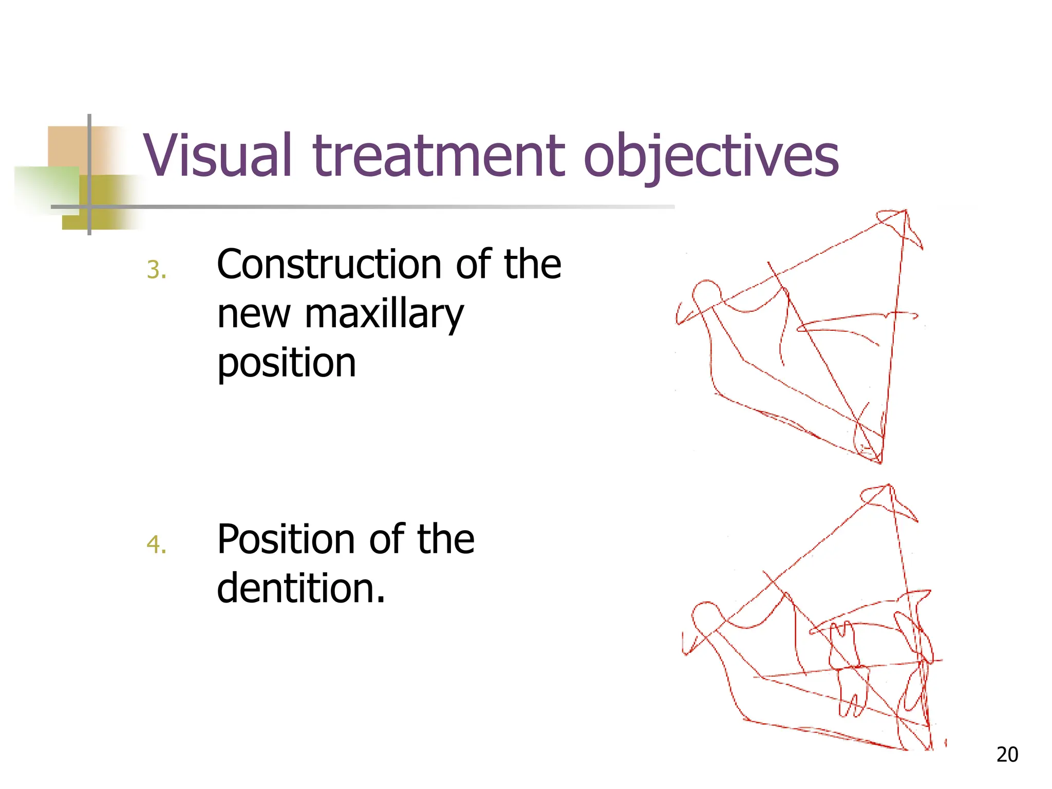 Bioprogressive Therapy in orthodontics by Ricketts | PPT
