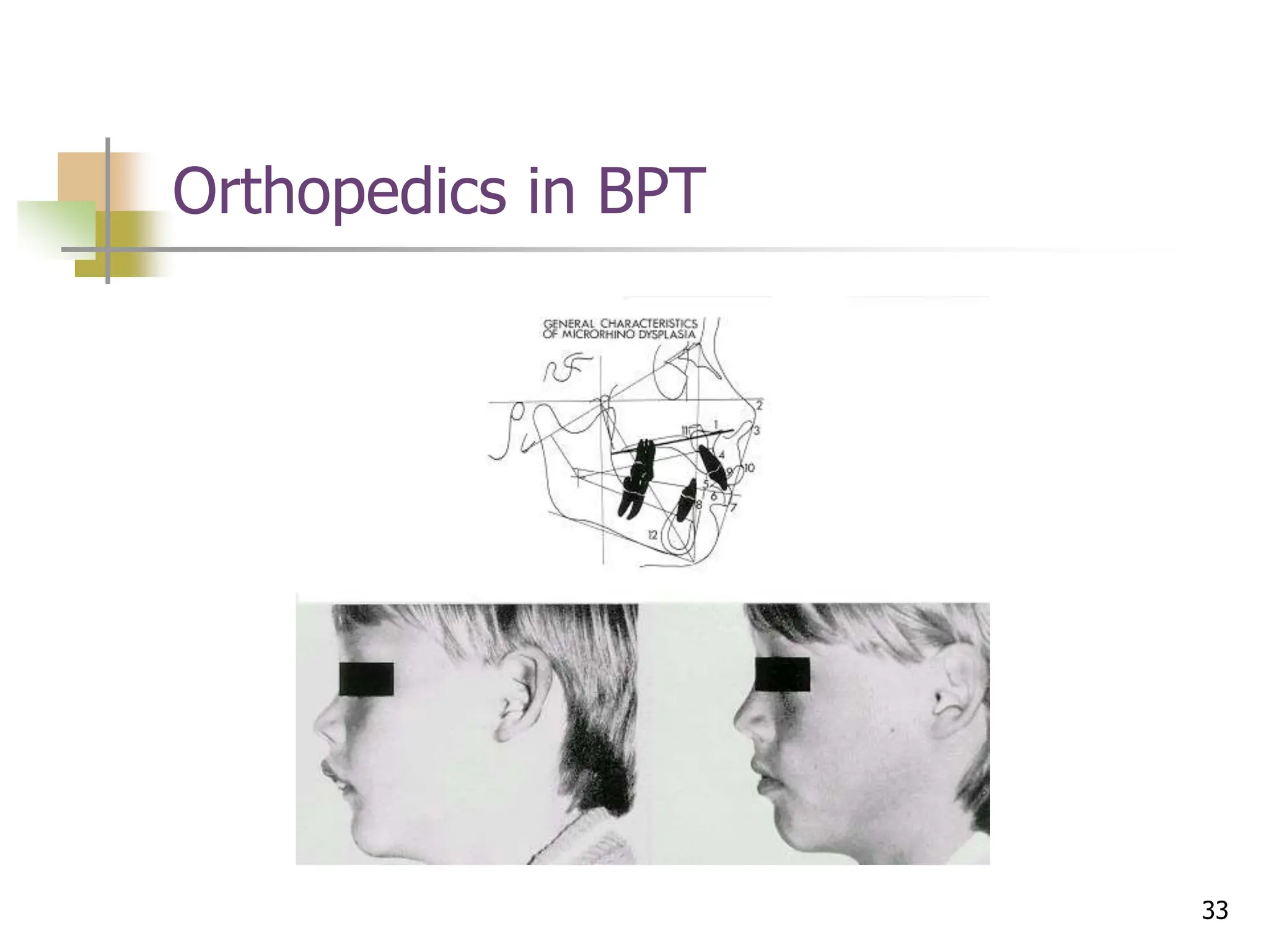 Bioprogressive Therapy in orthodontics by Ricketts | PPT