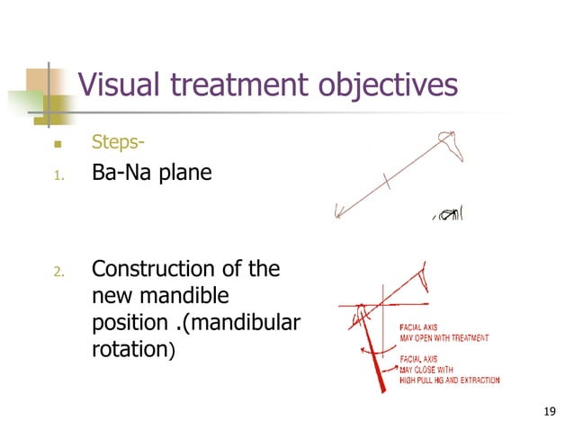 Bioprogressive Therapy in orthodontics by Ricketts | PPT