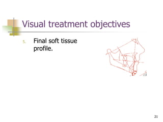 Bioprogressive Therapy in orthodontics by Ricketts | PPT