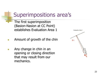 Bioprogressive Therapy in orthodontics by Ricketts | PPT