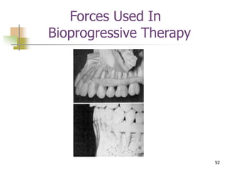 Bioprogressive Therapy in orthodontics by Ricketts | PPT