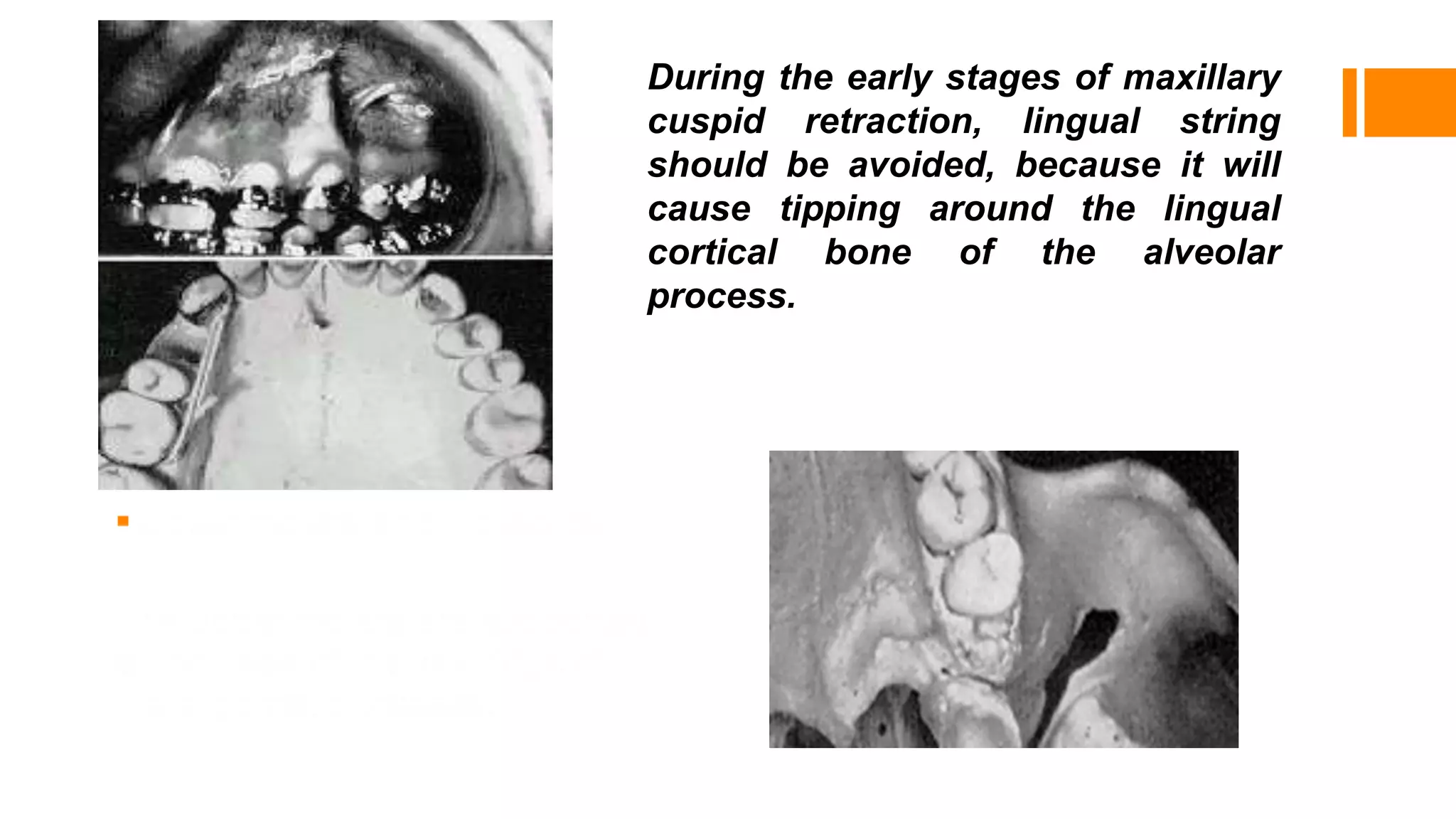 Bioprogressive therapy , dental , ricketts , medical , journal , bpt ...